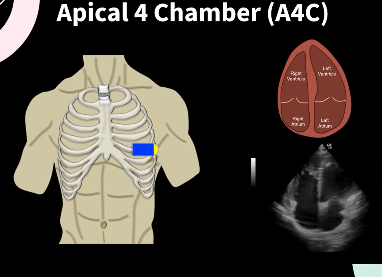 Identifying and Obtaining Standard Echocardiographic Views – Handbook ...