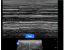 Key Signs and Interpretations in Lung Ultrasound – Handbook of Point of ...