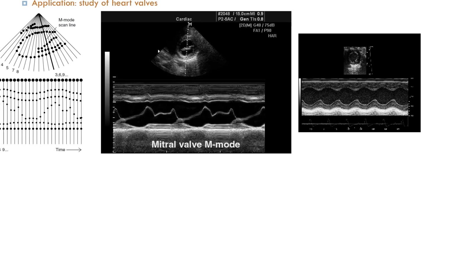 Preparing for Ultrasound Scan, Basic Image Acquisition – Handbook of ...